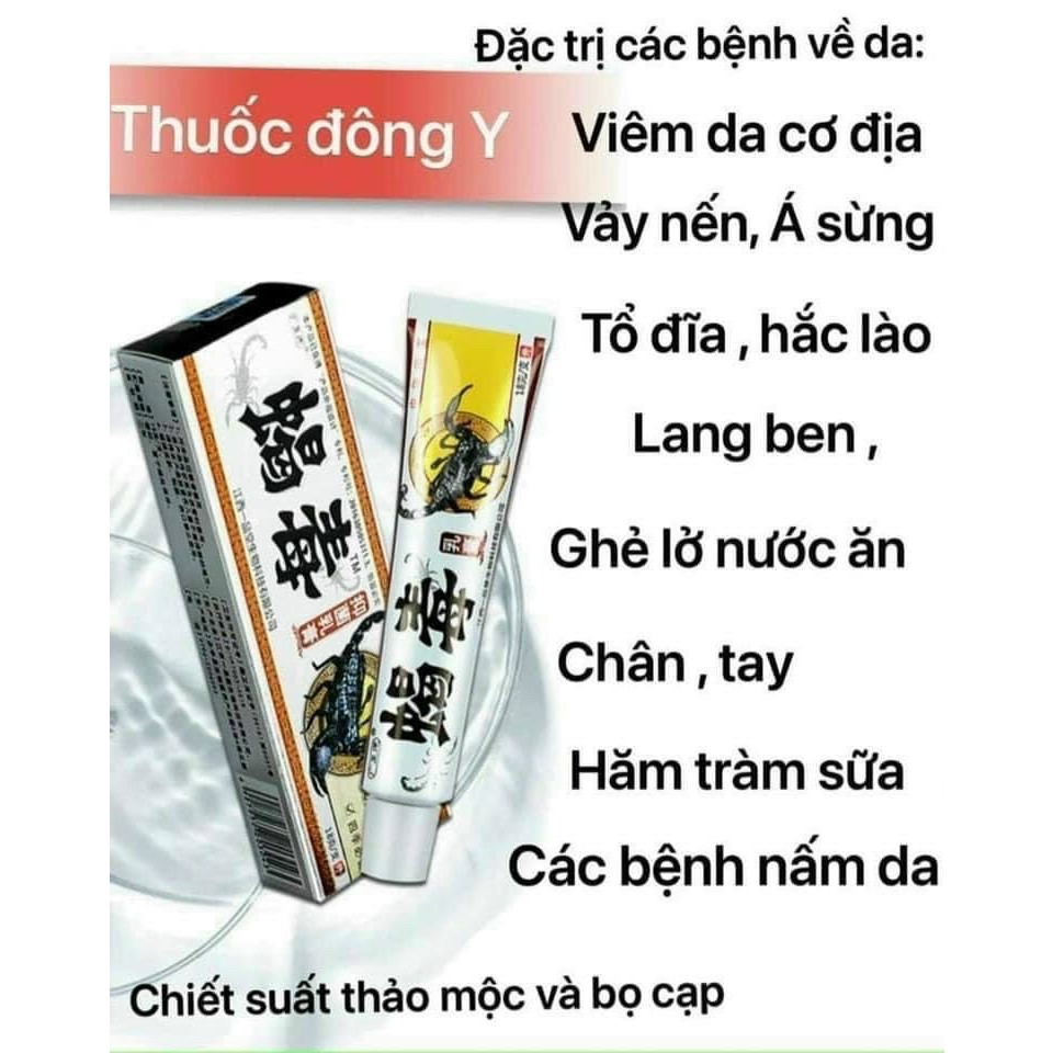 Topical cream to help treat itchy fungal dermatology, tinea versicolor ...