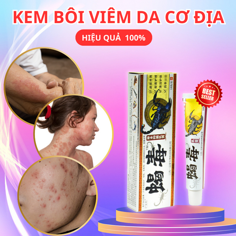 Scorpion Skin Topical Cream Supports Black Fungus Itchy Head Eczema ...