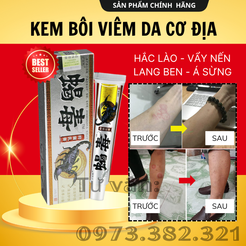 Scorpion Atopic Dermatitis Cream Helps To End Dark Spots, Scalp Fungus ...