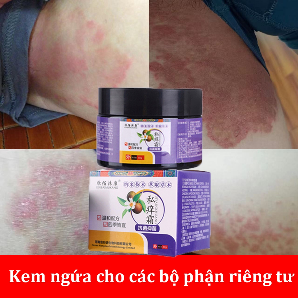 Ringworm cream 30g itchy cream Japanese itchy fungus cream itchy skin ...