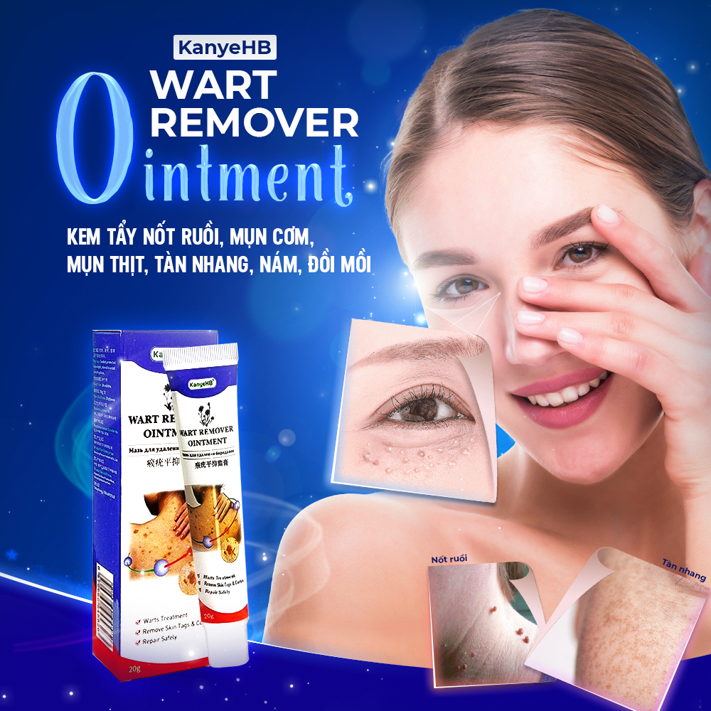 Kanyehb skin tag removal cream is effective, safe, easy to use | Shopee ...