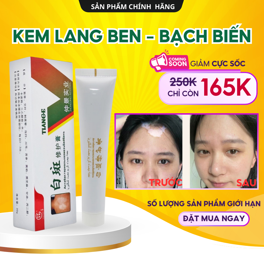 Tiange Tinea versicolor cream effectively helps stop tinea versicolor ...