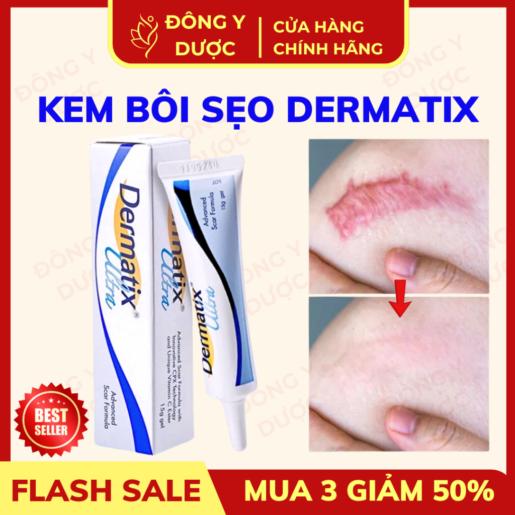 Dermatix Ultra Scar Gel Restores Scar Skin and Flattens, Fills Keloid ...