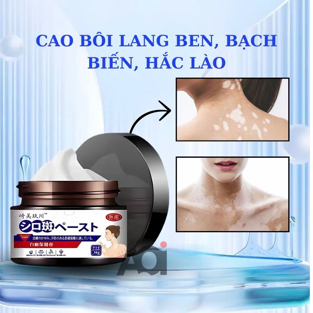 [Genuine] Sakimi topical cream to fade tinea versicolor, vitiligo ...