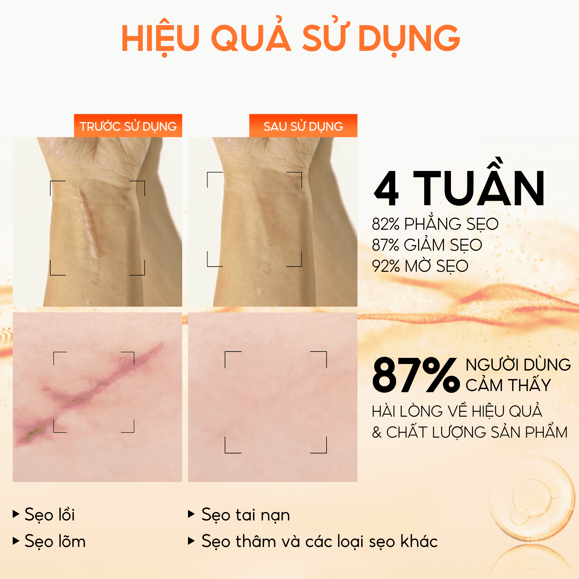 Scar Abera red turmeric Scar cream fades all types of pitted scars ...