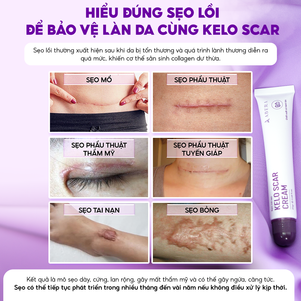 Kelo Scar Abera Keloid Scar Fading Cream - Supports the Fade of Keloid Scars, Hypertrophic Scars ...